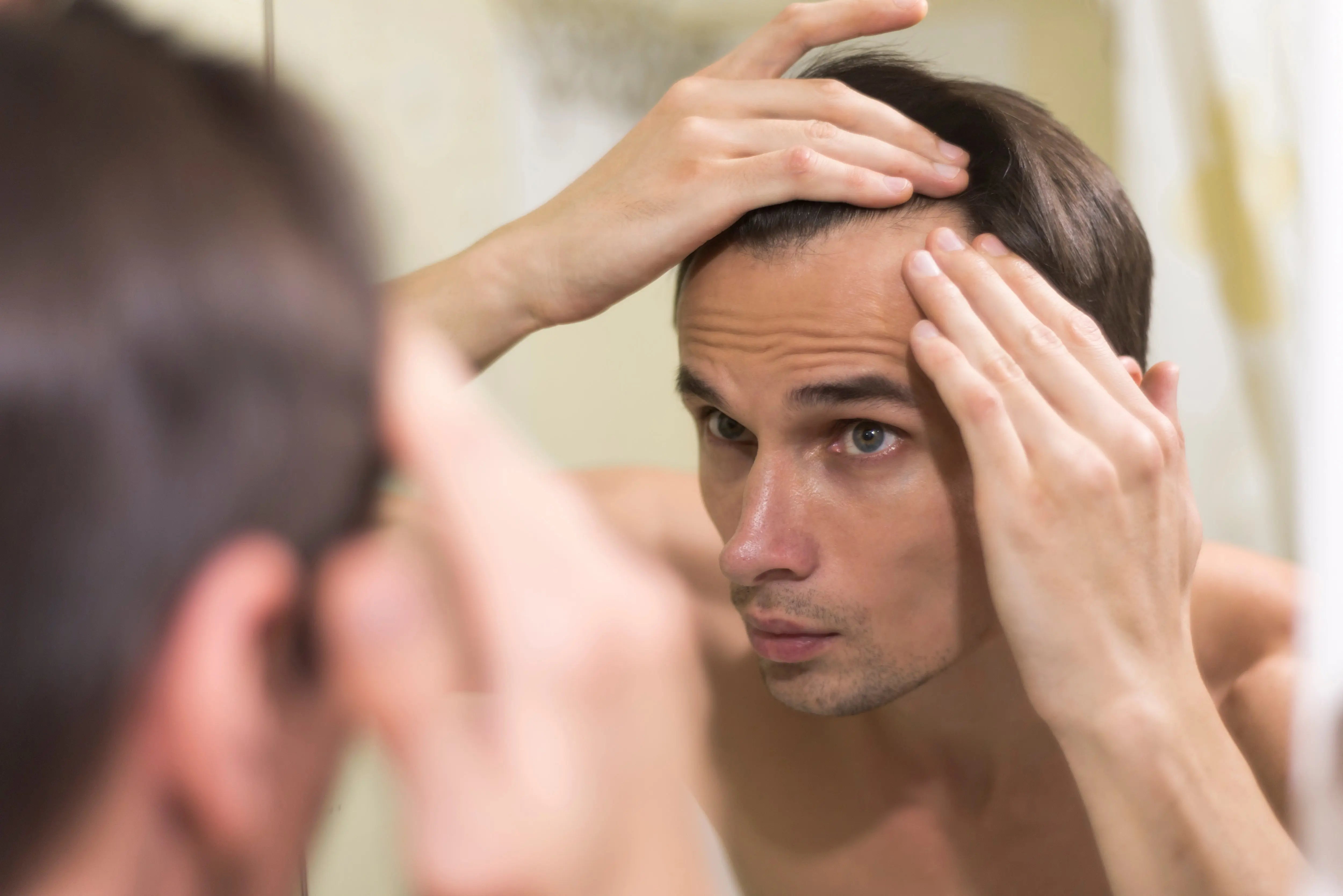 Topical Finasteride: A Game Changer in Hair Loss Treatment - Classic ...