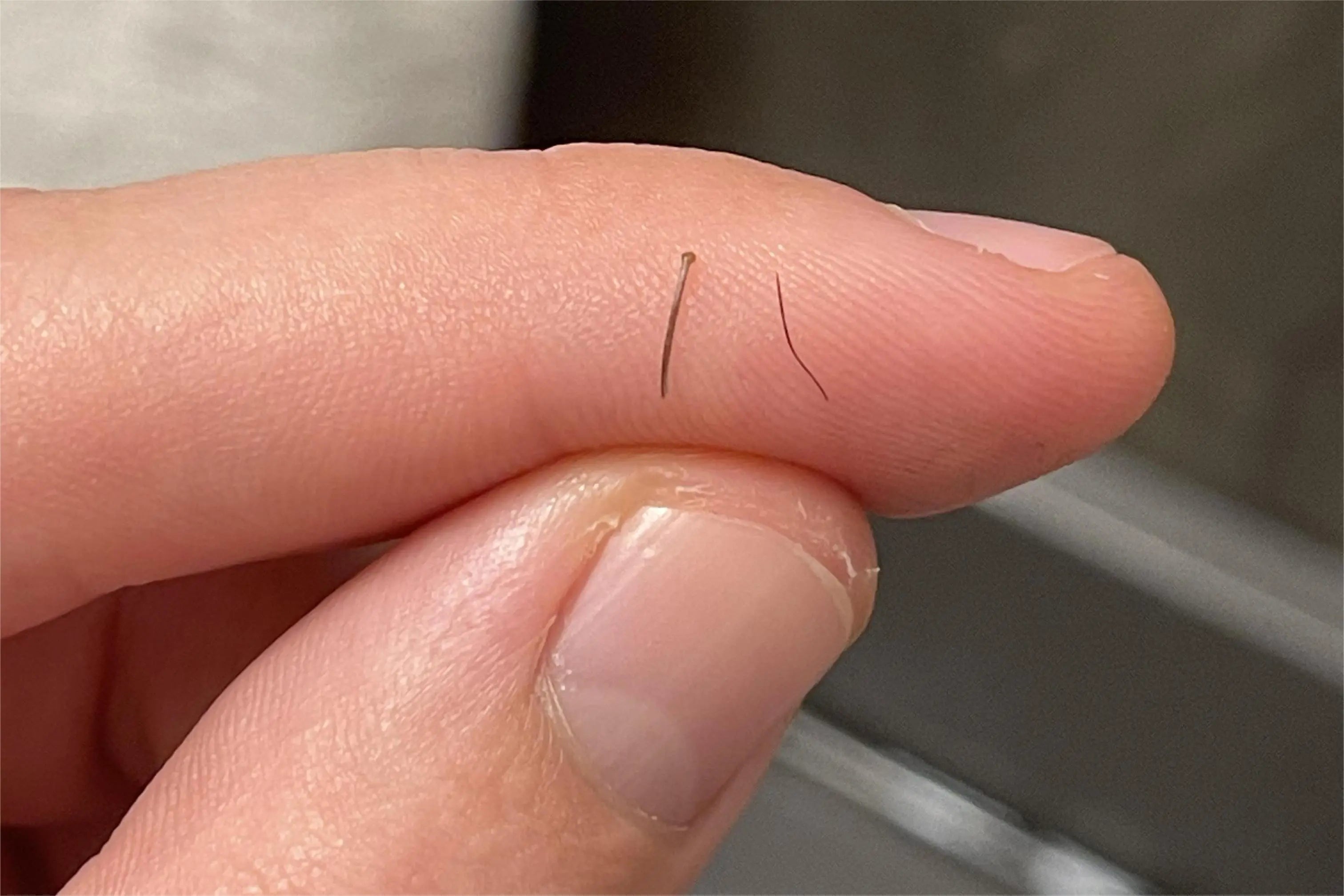 Understanding Hair Splinters: Causes, Symptoms and How to Prevent Them ...